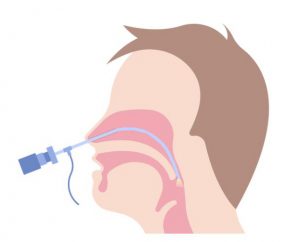 FEES: onderzoek naar slikproblemen met de endoscoop | HMC