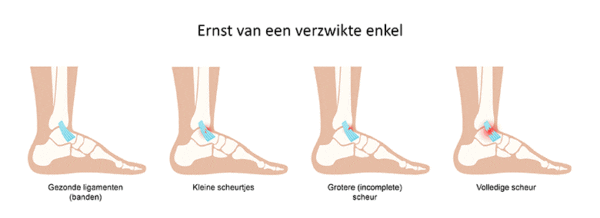 Behandeling van een enkelblessure of voetblessure | HMC